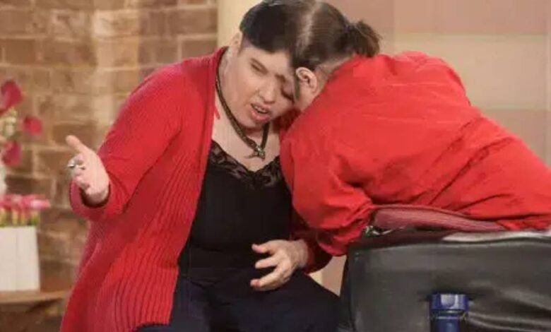 Mueren Lori y George Schappell, los gemelos siameses más longevos – El ...